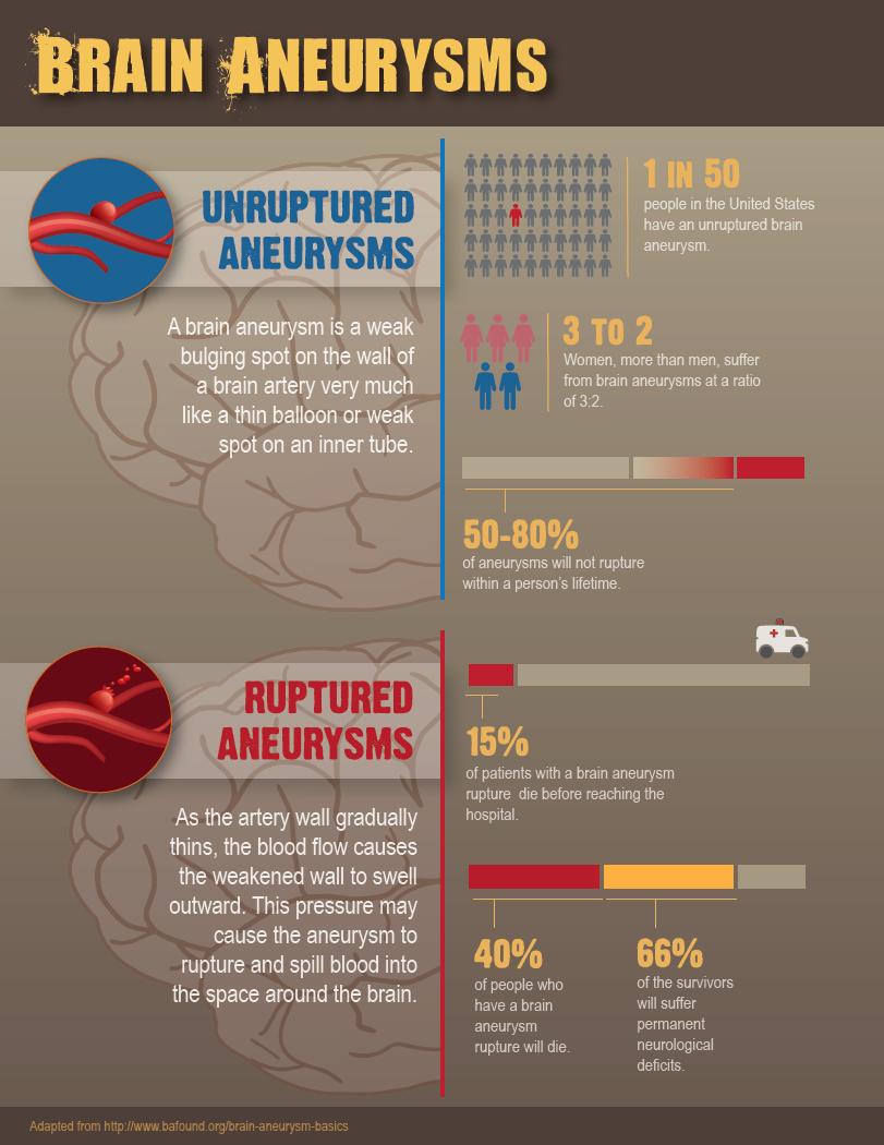 Brain Aneurysms - Becky Menendez